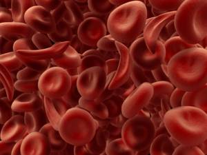 Drépanocytose - hopital.fr - Fédération Hospitalière de France